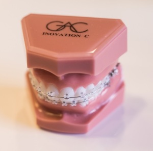 Orthodontic Appliances | Orthodontic Clinic Beaumont